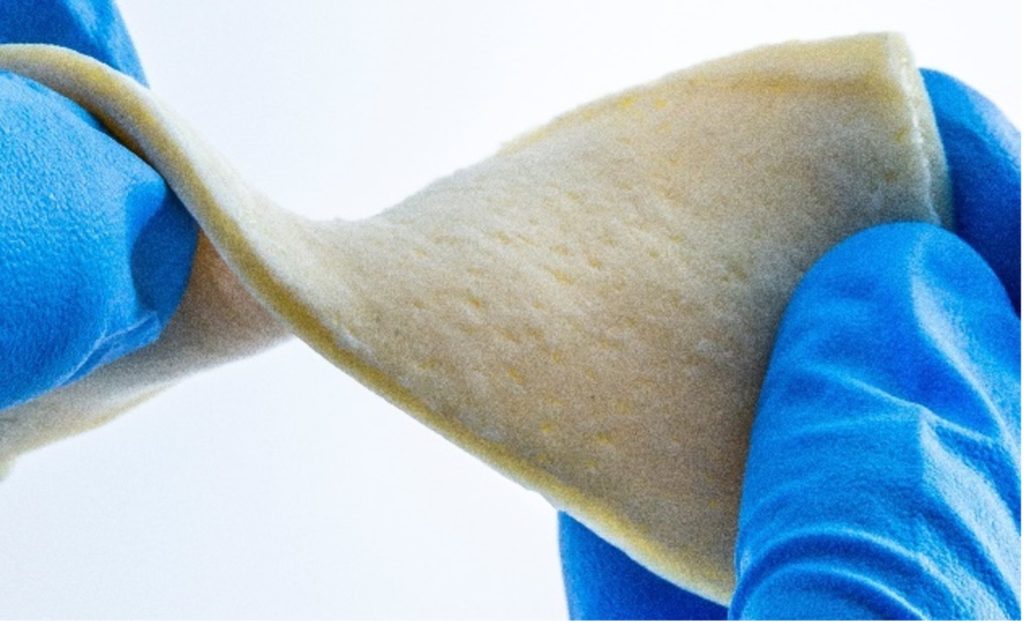 AlloMend® Ultra-Thick Acellular Dermal Matrix - AlloSource