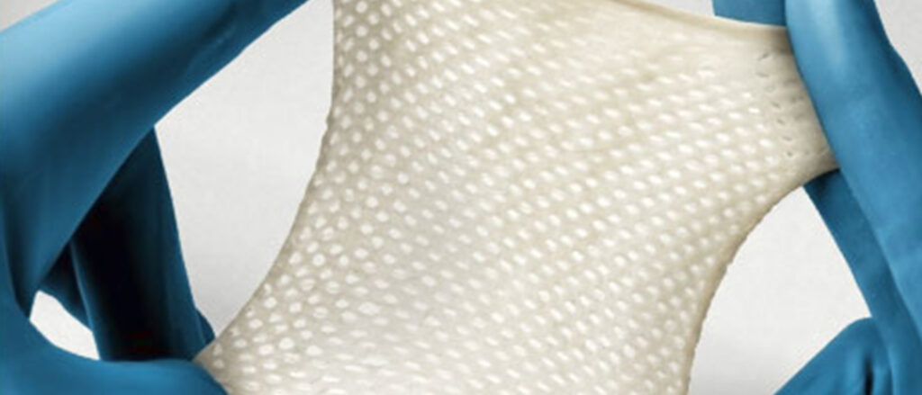 AlloSkin™ - AlloSource