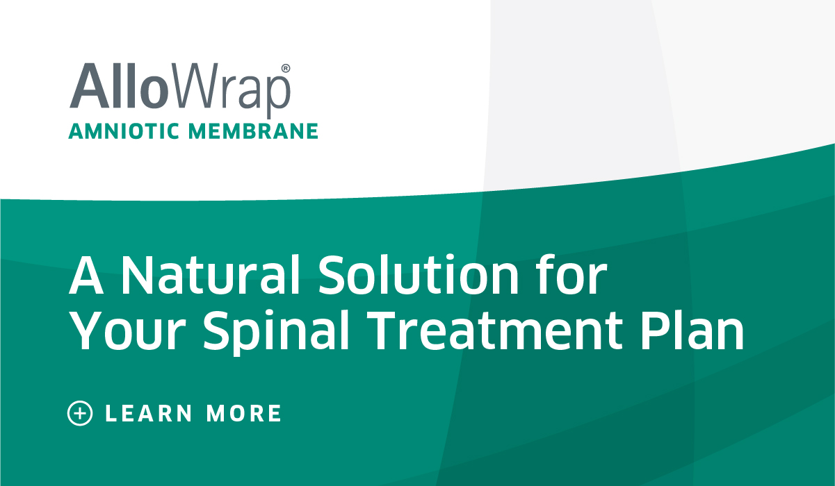 Products - AlloSource