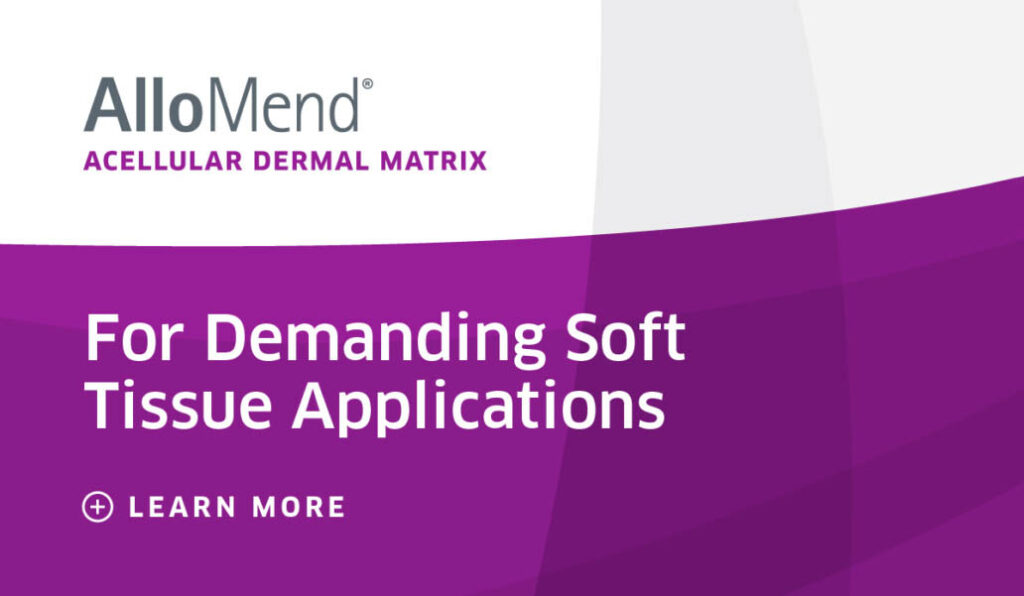 Products - AlloSource