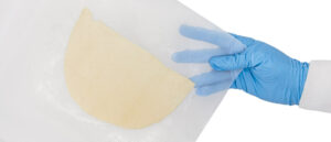 AlloMend® Mesh Shaped - AlloSource