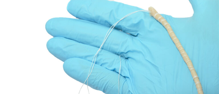 AceConnex® - AlloSource