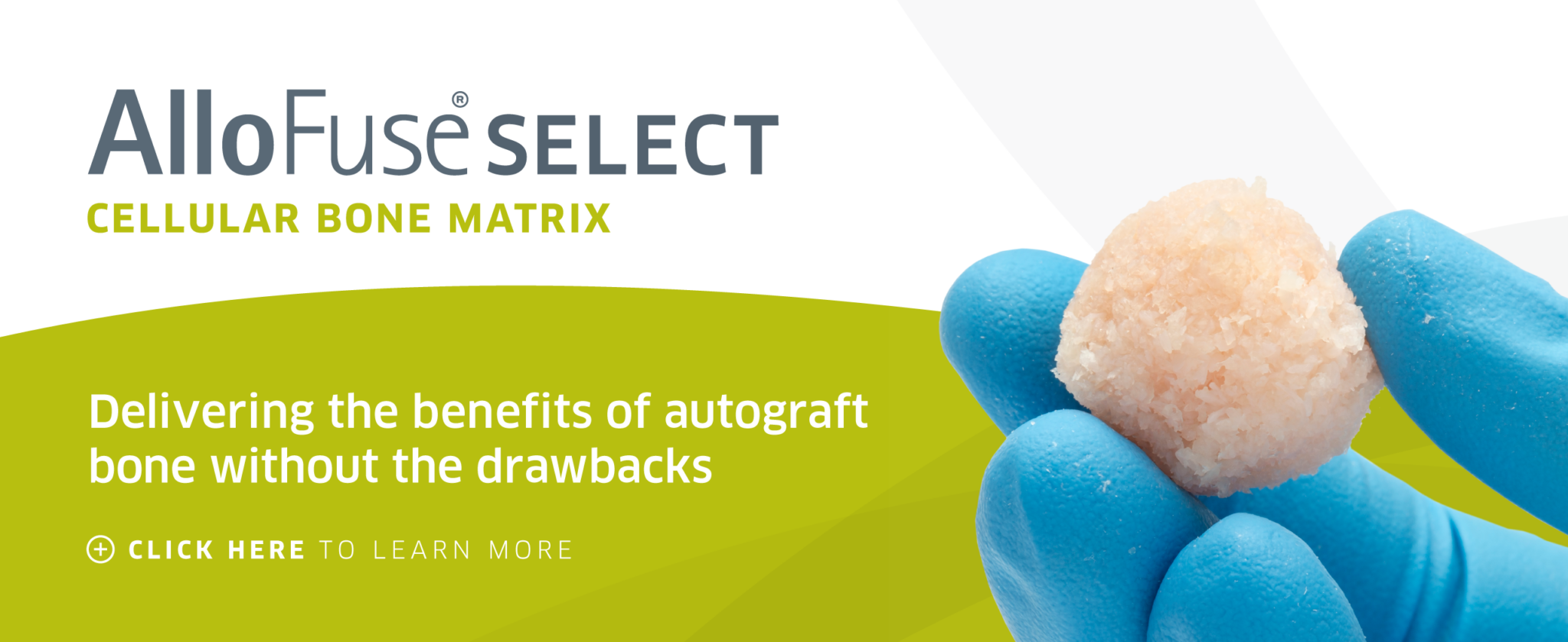 AlloSource - Doing More With Life