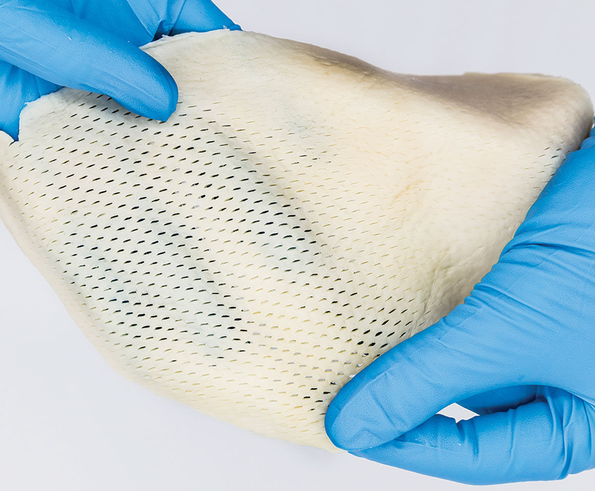 AlloSource - Doing More With Life